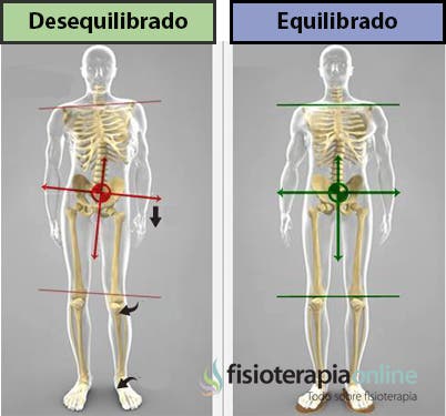 Equilibrio postural y disfunciones articulares o como las postura afecta a nuestro organismo ...