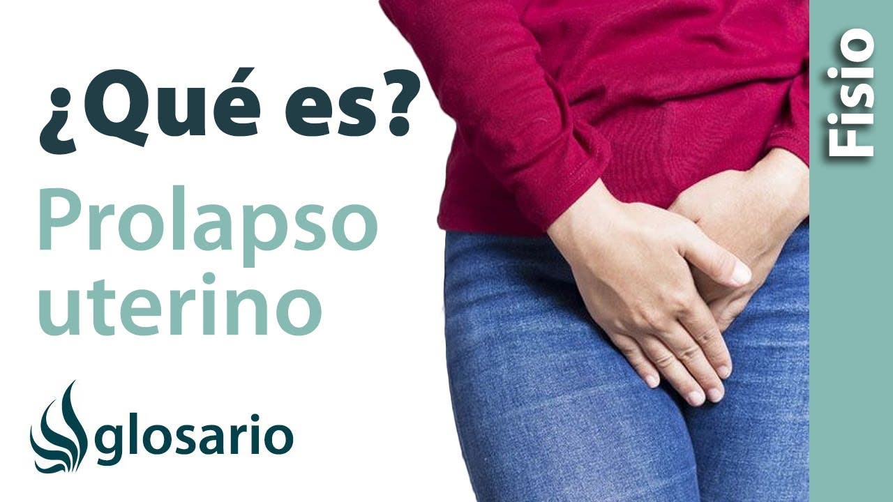 Prolapso De Vejiga Vs Prolapso Uterino