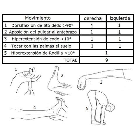 Todo sobre la Hiperlaxitud Articular | Fisioterapia Online