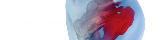 Lesiones de cadera y pierna y sus cuidados | FisioOnline