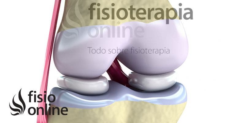 Condromalacia rotuliana. Qué es y cuales son las causas, síntomas y ...