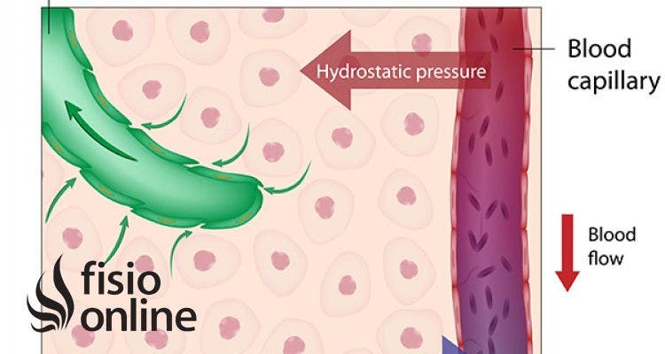 Edemas o retención de líquidos. Tipos, causas, diagnóstico y ...