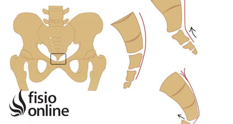 Fractura de cóccix. ¿ Cómo me puedo romper el cóccix? ¿Cómo tratarlo ...
