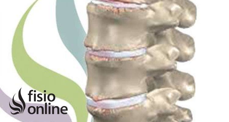 Infografías | Página 10 | FisioOnline