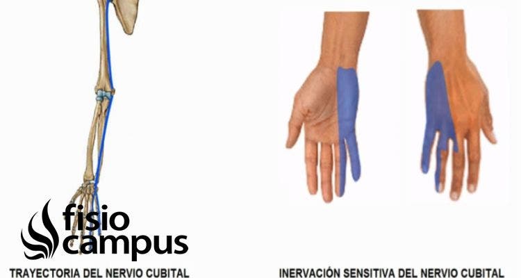 Cubital (nervio) | Qué es, ubicación, dónde se origina, recorrido ... Cubital (nervio) | Qué es, ubicación, dónde se origina, recorrido ...