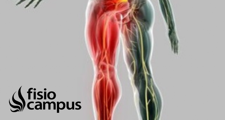 Dolor radicular | Qué es, características, en qué patologías aparece ...