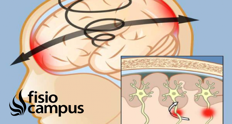 Lesión axonal difusa | Qué es, qué estructuras afecta, síntomas, signos clínicos, causas y ...