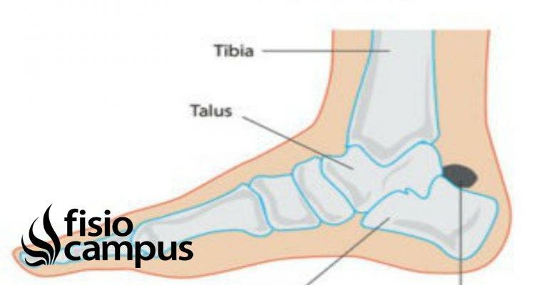 Os trigonum | Qué es, qué estructuras afecta, síntomas, signos clínicos ...