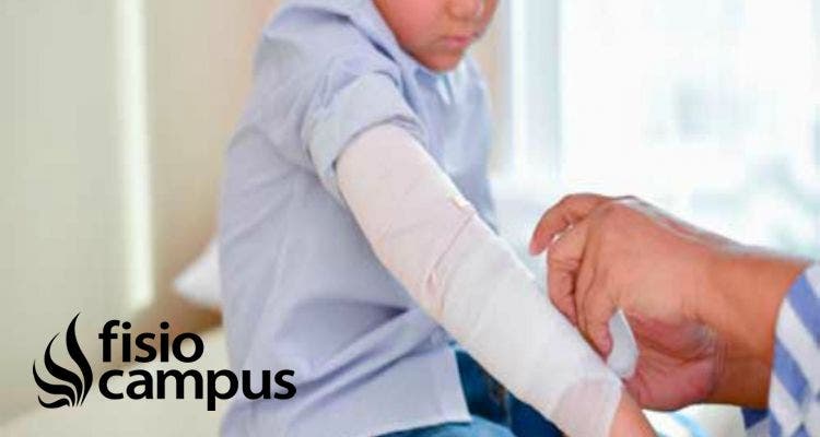 Osteogénesis imperfecta | Qué es, qué estructuras afecta, síntomas ...