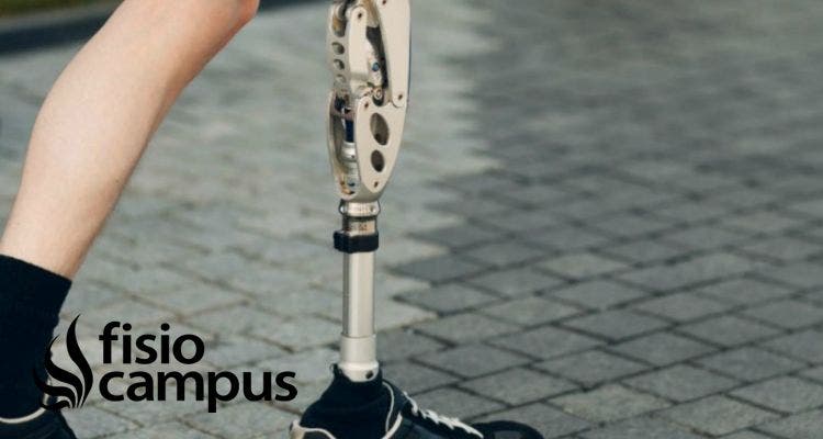 Prótesis | Qué son, tipos, finalidad, usos e importancia