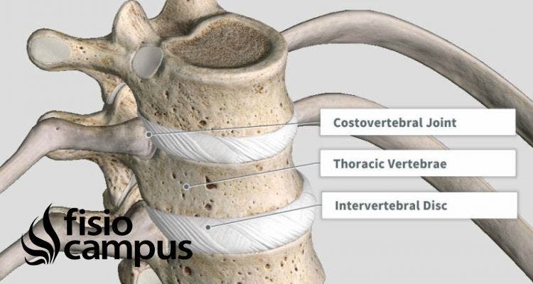 Síndrome costo vertebral doloroso | Qué es, qué estructuras afecta ...