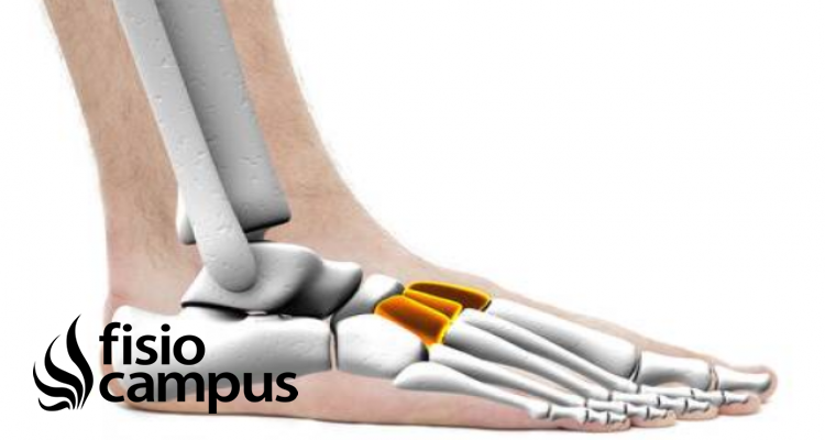 Cuñas o Cuneiformes │Qué son, significado, ubicación, función y lesiones