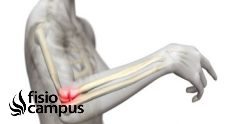 Epicóndilo | Qué es, significado, dónde está, función y lesiones