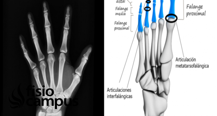 Falanges | Qué son, significado, dónde se encuentran, función y lesiones