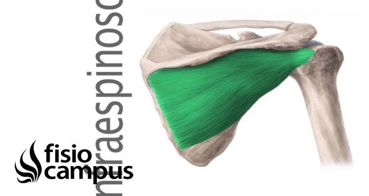 Infraespinoso | Qué es, cómo estirar y trabajar, origen, inserción ...