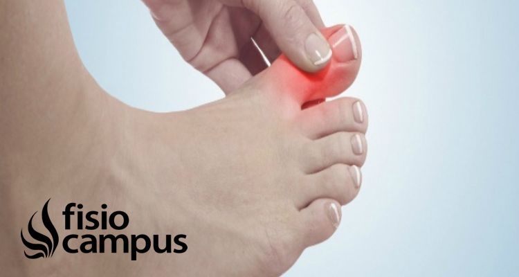 Necrosis | Qué es, características, en qué patologías aparece, por qué ...