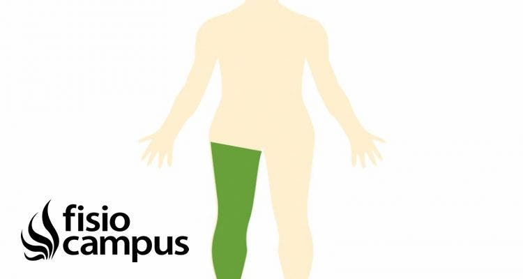 Paresia | Qué es, qué estructuras afecta, síntomas, signos clínicos ...