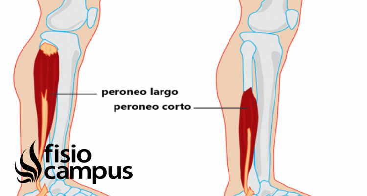 Peroneos | Qué son, ubicación, origen, inserción, función y lesiones Peroneos | Qué son, ubicación, origen, inserción, función y lesiones
