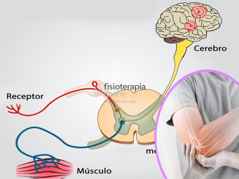Dolor reflejo | Qué es, características, en qué patologías aparece, por ...