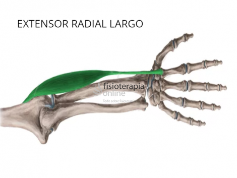 Extensor radial largo | Qué es, ubicación, origen, inserción ...