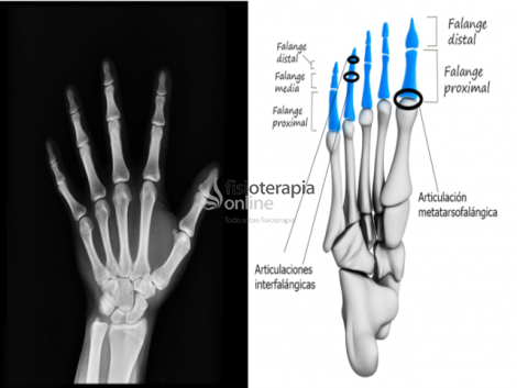 Falanges | Qué son, significado, dónde se encuentran, función y lesiones