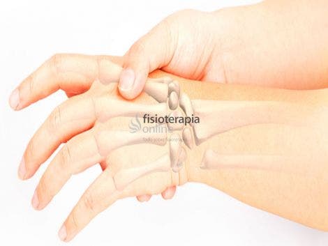 Metacarpo | Qué es, significado, dónde está, función y lesiones