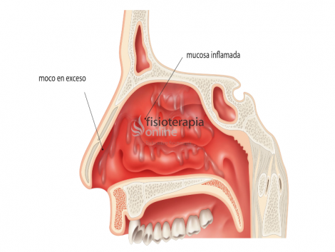 Mucosa | Qué es, significado, composición, ubicación, función