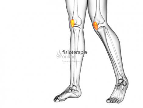 Rótula o patela | Qué es, significado, ubicación, función y lesiones