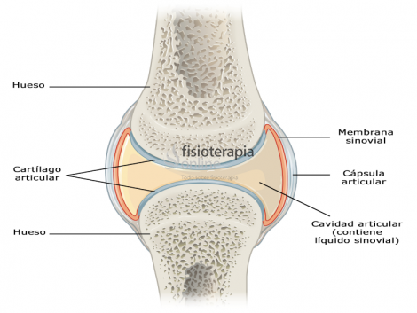 Sinovitis | Qué es, qué estructuras afecta, síntomas, signos clínicos ...