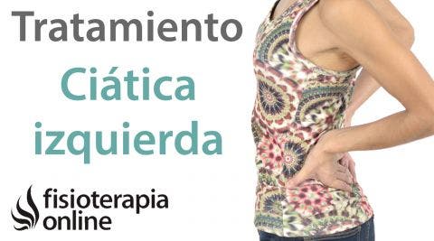 Tratamiento de ciática o ciatalgia izquierda | Fisioterapia Online