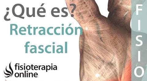 ¿Qué es y cuáles pueden ser las causas de la retracción muscular o ...