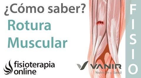 Tengo un tirón ¿Cómo saber si tengo una rotura muscular o una ...